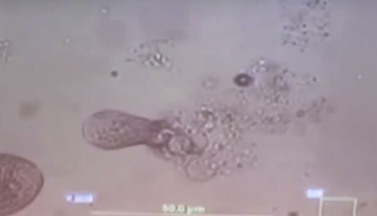 Antimicrobial | Fusion Resonance